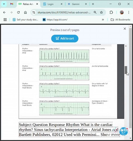 Relias Advanced Dysrhythmia Exam A Study Guide