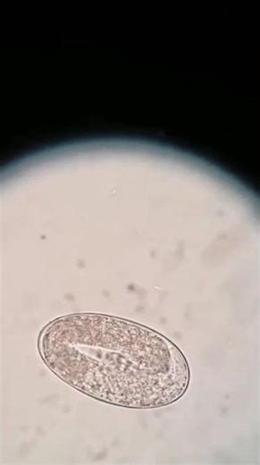 parasitology | H Nana | hymenolepis nana under microscope | Tapworm | stool examination | H nana