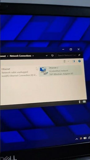 How To Find Your Network Speed on Windows 10 📡#shorts