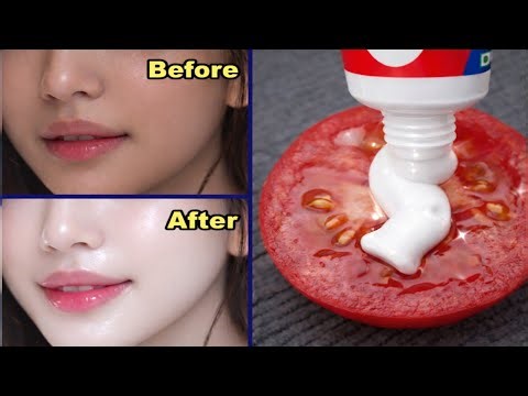 Colgate toothpaste For Face Whitening | Tomato And Colgate