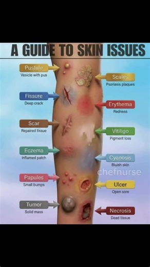 A Guide to skin issues #doctorduo #ytshorts #drkanikapopli #skincare #dermatologist #gk #ytshorts