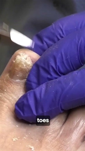 Navigating Insurance for Health Coverage