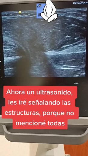 Understanding Hernia Epigastrica with Ultrasound Imaging