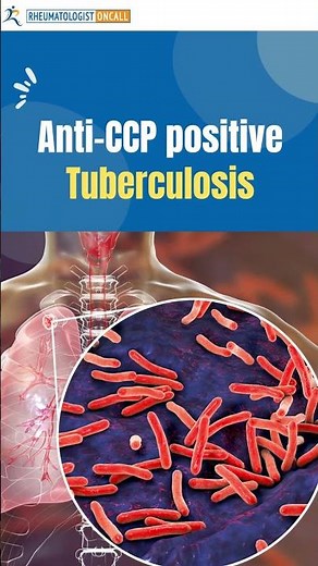 Anti-CCP antibodies (Anti-citrullinated peptide antibodies ) test - what does it mean?