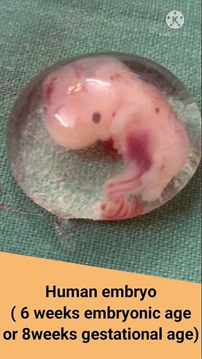 Human embryo at 8 weeks of gestational age # embryology