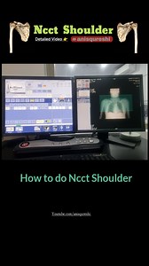 3.4K views · 489 reactions | NCCT Shoulder | From Topo to End Exam —...
