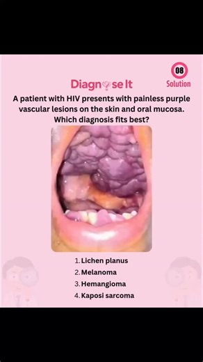 Diagnose it on Instagram: "Treat patient like real doctor on "Diagnose i"t app History -> lab test -> diagnosis -> treatment -> clinical insight try "Diagnose it" completely free game on app and play store #doctor #medical #meds #medicalschool #mbbs #pg"