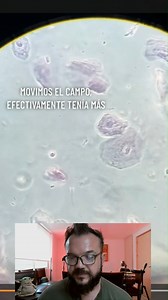 14 reactions · 3 comments | Las indicaciones correctas en tú EGO, Probablemente no te vayan a decir esto.  Pero te recomiendo mucho preguntar a la persona que te atiende en el laboratorio. 喝 Suscribete al canal para mas morbo, dale like a la publicación y comenta.  #colesterol #glucosa #laboratorioclinico #masturbarse #viral #ego #ginecologa #bebé #consulta #rifa #concurso #agujas #laboratorio Dr. Tomas Tijerina American Lab | DepoDental Plus | Facebook