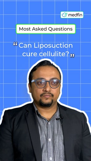 Medfin on Instagram: "Can liposuction really fix cellulite? 🤔 Here’s where people get it wrong. Cellulite isn’t just fat — it’s the way the skin sits over the tissue underneath, kind of like the dimpled surface of an orange. In this reel, Dr Vybhav Deraje, Consultant Plastic Surgeon, explains why cellulite and fat aren’t the same thing, and why liposuction isn’t a cure for that dimpled appearance. Understanding what cellulite actually is helps you set real expectations and choose procedures for