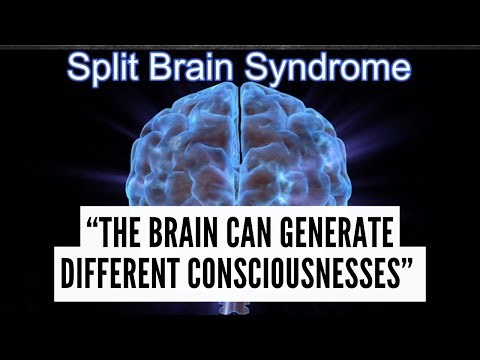Each hemisphere can generate a separate consciousness (Roger Sperry Nobel Prize Winner)