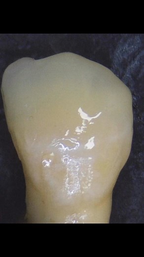 Practice, microscope dentistry. | Justin Mogol Dmd