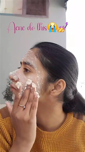 *Oily Acne Skin* Try This Homemade Paste Once! ✨ #skincare #minivlog #acne #pimple #ytshorts