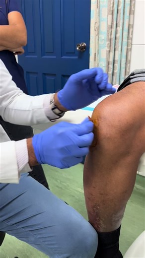 Effective Knee Pain Treatments for Osteoarthritis Relief