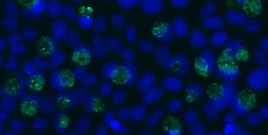 Unlocking Chlamydia’s persistent state »  Emerging Pathogens Institute » University of Florida