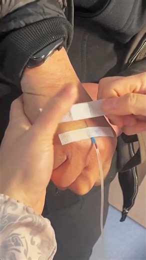 Flawless IV Placement! 💉 Butterfly Needle Technique for Difficult Veins