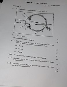 QUESTION 3: The Eye – Functioning & Visual DefectThe diagram ... | Filo