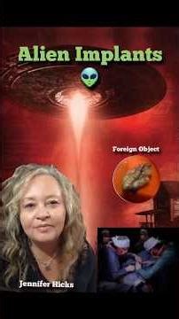 Alien Implants 👽