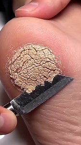 Foot Care Natural Touch | Satisfying Scrape HYPI #SkincareASMR #PoreCleaning #ClearSkinJourney #SatisfyingSkincare #FacialCleansingRoutine Enjoy calm, clean, and deeply satisfying skincare moments with gentle blackhead suction and a soothing visual experience designed to refresh and relax. Disclaimer: This video is created for educational and relaxation purposes using AI-generated blackhead-removal demonstrations. | Mojar Cartoon