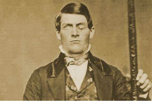 What Happened to Phineas Gage?
