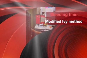 Bleeding Time: Modified Ivy Method