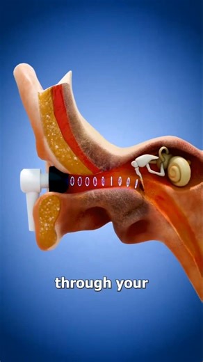 Zyada Loud Music ? Aapke kaan kharab ho sakte hain🎧 #loudmusic #hearingloss #shorts #youtubeshorts