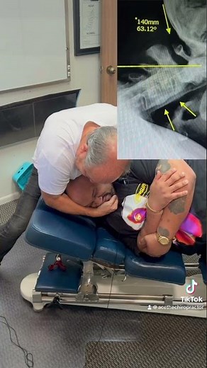 Ankylosing Spondylitis treated by Chiropractor 1/6