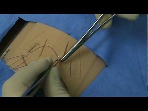 Simple Interrupted Suturing Technique [Tulane Medicine]