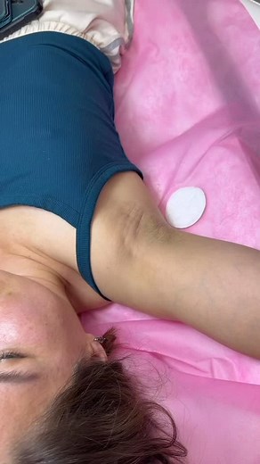 ⚡ Why Choose Electrolysis? Unlike other methods, electrolysis doesn’t just remove the hair — it destroys the follicle itself. That means the result is permanent 💥 Laser hair removal works only when there’s pigment in the hair. But electrolysis targets each follicle individually, so it’s effective on any skin tone and hair color — even light or grey hair! 🤍 ✨ Smooth skin forever — not just for a few months. #austin #atxesthetician #austinwomens #atxdomain #electrolysis | VS beautty