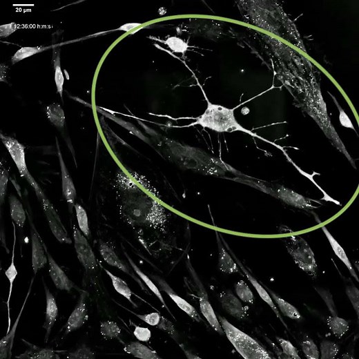 Label-Free Imaging of Morphological Changes During Stem Cell Differentiation