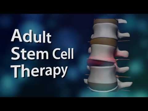 What is Stem Cell Therapy- Trinity Spine and Wellness Center New Port Richey