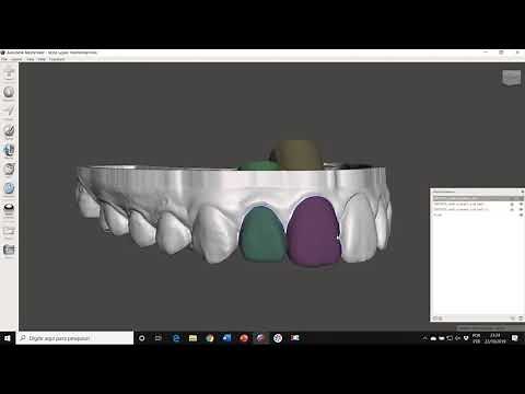 Meshmixer Setup Pivot