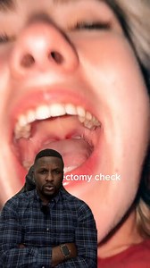 11K views · 49 reactions | A Tonsillectomy is the surgical removal of your tonsils. It’s done to treat breathing issues or with frequent infections.Do you still have your tonsils? #tonsils #tonsillectomy #tonsillitis #earnosethroat | The Whiz Doc | Facebook