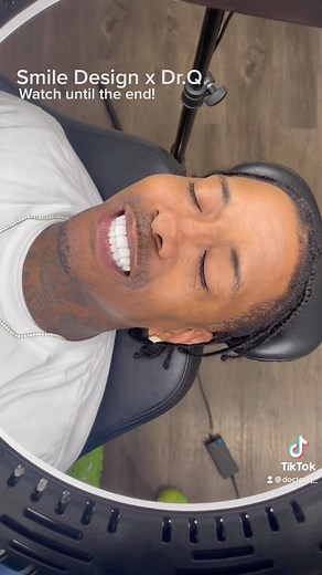 Dr.Q | Full Mouth Rehabilitation! Extractions, Bridges, Decay Removal, Restorations, Gold Removal & Veneer Placement! Smile Design Dr.Q | Instagram