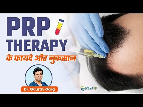 Side Effects of PRP Hair Treatment | Side effects of Platelet-Rich Plasma Therapy (PRP)