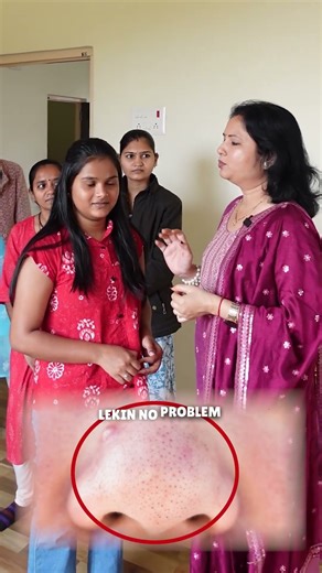 ब्लैकहेड्स पिघलाने का देसी तरीका | चावल + तुलसी से पोर्स होंगे क्लीन