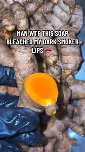 4.1K reactions · 409 shares | Dark lips? No SHAME ❌ Our flourishing...