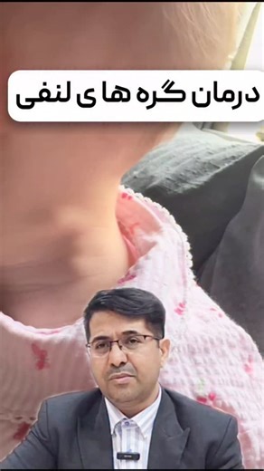 ‎نکات طب سنتی دکتر زارعی🌱‎ on Instagram‎: "گره‌های لنفی، فیلترهای دفاعی بدن هستن. وقتی متورم می‌شن، معمولاً نشونه‌ی عفونت، التهاب یا واکنش سیستم ایمنیه. تشخیص درست، پیگیری پزشکی و تقویت بدن با تغذیه‌ی سالم نقش مهمی در بهبود دارن هر ورمی خطرناک نیست، اما هیچ علامتی هم نباید نادیده گرفته بشه. هشتگ‌ها: #گره_لنفی #غدد_لنفاوی #سیستم_ایمنی #التهاب #آگاهی_سلامت #سلامت_بدن #پیگیری_پزشکی #سبک_زندگی_سالم #بدن_سالم"‎