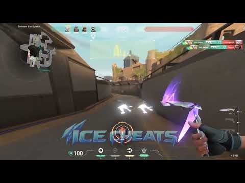 Best VALORANT Config SETTINGS | Hard aiming playstyle | ICE METHOD | Best Valorant UD Cheat