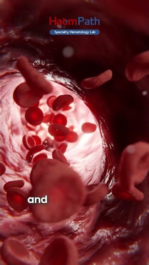 Looking Beyond Common Causes of Bleeding | Haemophilia | Haempath Diagnostics | Ahmedabad | Gujarat