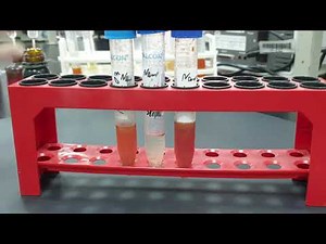 Nitrate reduction test Results