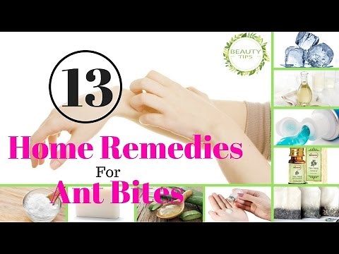 Top 13 Home Remedies For Ant Bites | BEAUTY TIPS