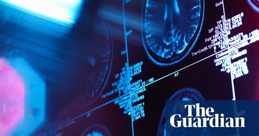 Neural Impact of Structural Inequality: How Socioeconomic Disparities Shape Children's Brain Development – Archyde