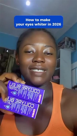 How to Make Your Eyes Whiter Naturally at Home