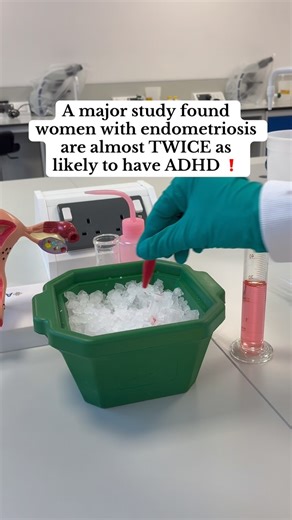 PROJECT ENDO on Instagram: "Does this resonate with you? 🧡 A large Swedish population-based study of 854,361 women found a strong link between endometriosis and mental health, showing a high level of overlap with multiple psychiatric disorders that cannot be fully explained by familial factors. Understanding these connections is critical to improving diagnosis, treatment, and long-term support for those living with endometriosis. 🖤 (video repost via @ditto.daily)"