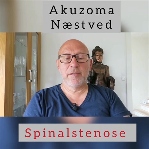 Har du smerter i lænden – måske ned i balde eller ben? Så kan det være spinal stenose i lænden – en forsnævring i rygkanalen, der trykker på nerverne. Typiske symptomer kan være: • Smerter i lænd og ben • Prikken, sovende fornemmelse eller “tyngde” i benene • Besvær med at gå længere stræk • Lindring når du sidder eller bøjer dig frem Hos AkuZoMa arbejder jeg med akupunktur, muskelafspænding og smertereduktion, så kroppen får ro og bevægeligheden kan bedres. 👉 Du behøver ikke gå alene med smert