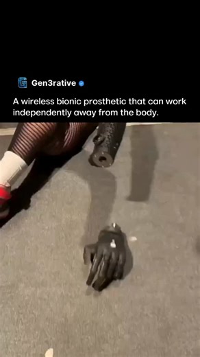 AI | Technology on Instagram: "future of prosthetics: wireless bionic arm that gives people their strength back #ai #artificialintelligence"