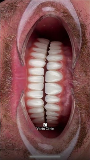 Stephen had lost his spark. hiding his smile for years. 😣❓🦷