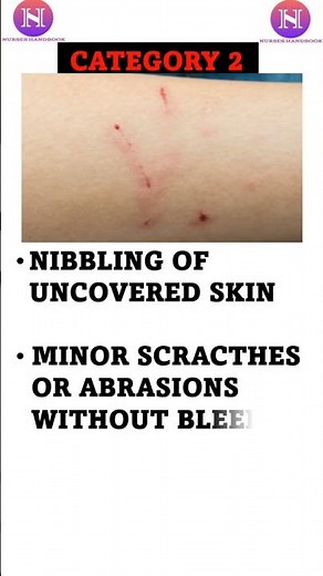 #categories of animal bite