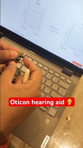 How to Change Oticon Rechargeable Hearing Aid Battery.Step by Step Guide (2025) #oticon #hearingaids