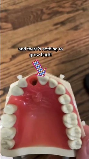 Here’s what happens when your tooth falls out! #dentist #babyteeth #braces #brushyourteeth #smile